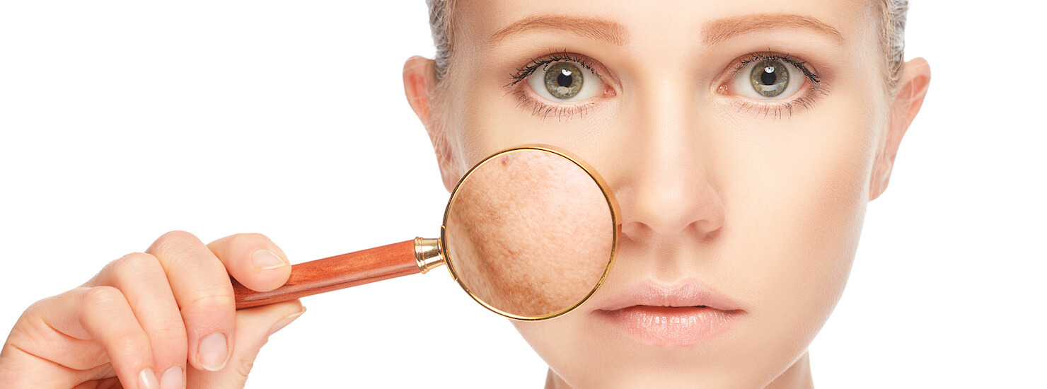 Sun Damage Treatments in Surrey (Vancouver) | Advanced Skin Care ...