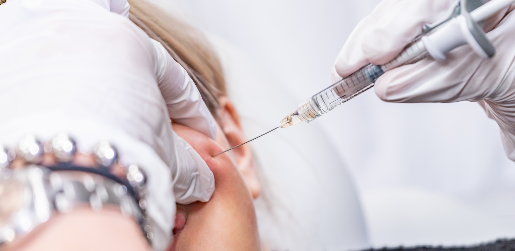 Juvéderm® Vancouver | Juvéderm® Surrey, White Rock, Langley, Delta ...