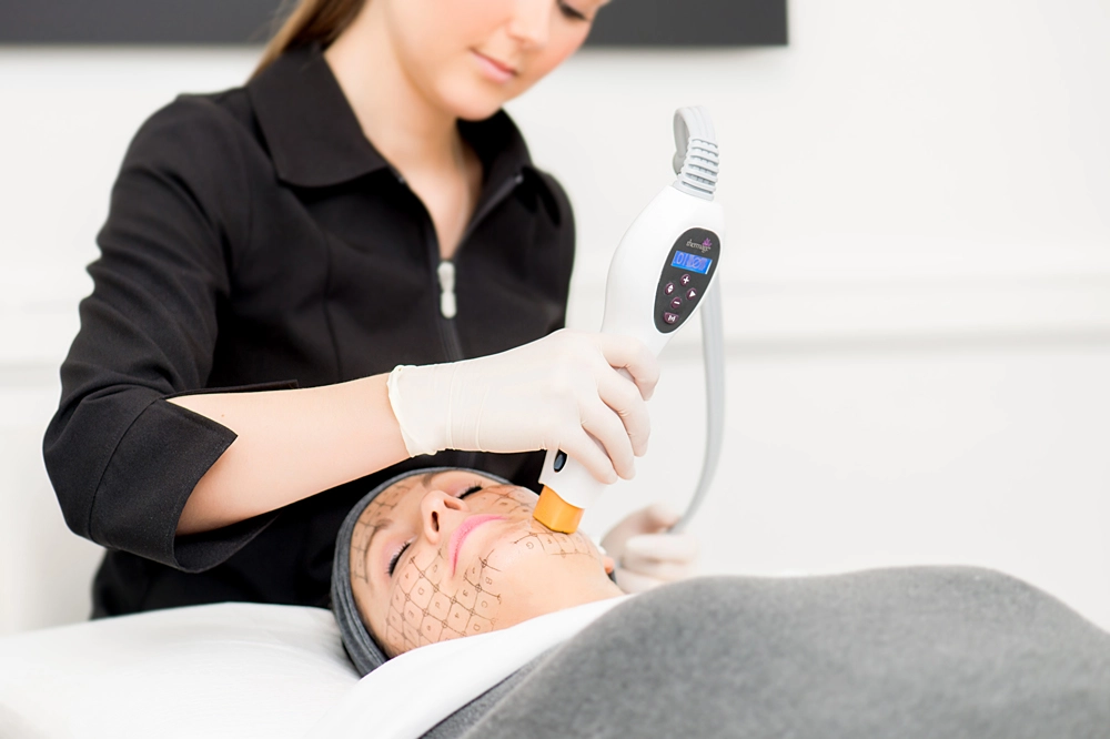 Thermage® - Beautiful Canadian Laser and Skincare Clinic
